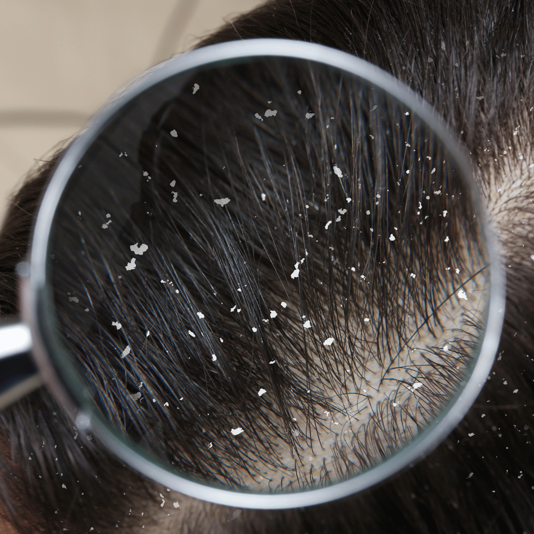 What is Trichology – The Institute of Trichologists